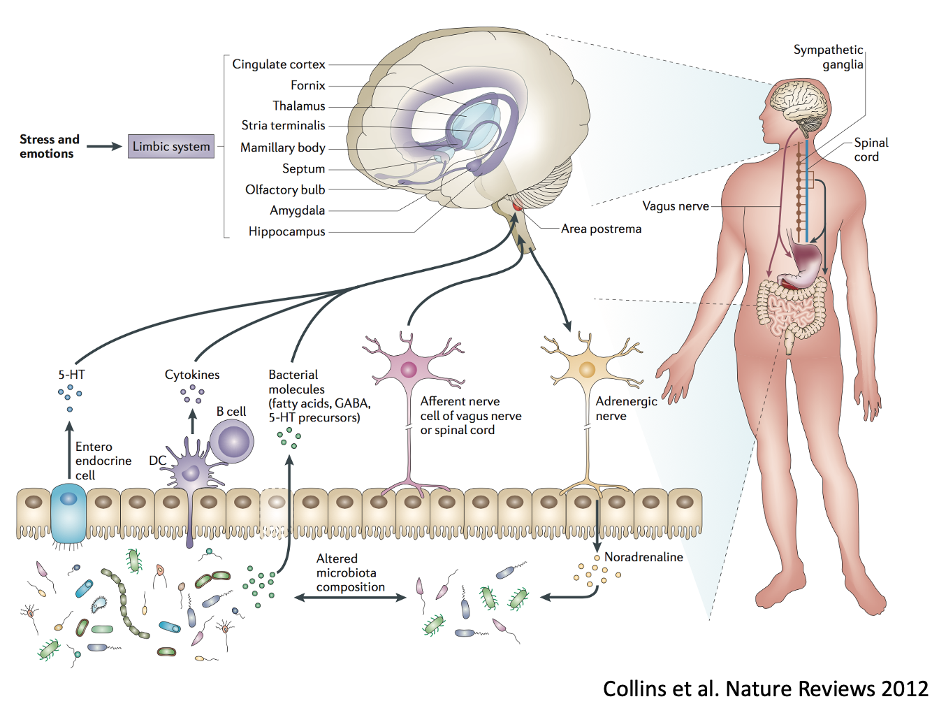 Catecholamines helpful or harmful in critical illness? – EvolutionMedicine